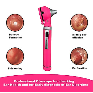 Cross Canada 11-080 Physician Fiber Optic LED Pocket Otoscope Diagnostic Set - Pink