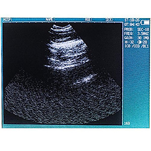 Veterinary WristScan Ultrasound Scanner Machine Handscan for Farm Animals with 3.5MHz mechanical sector probe