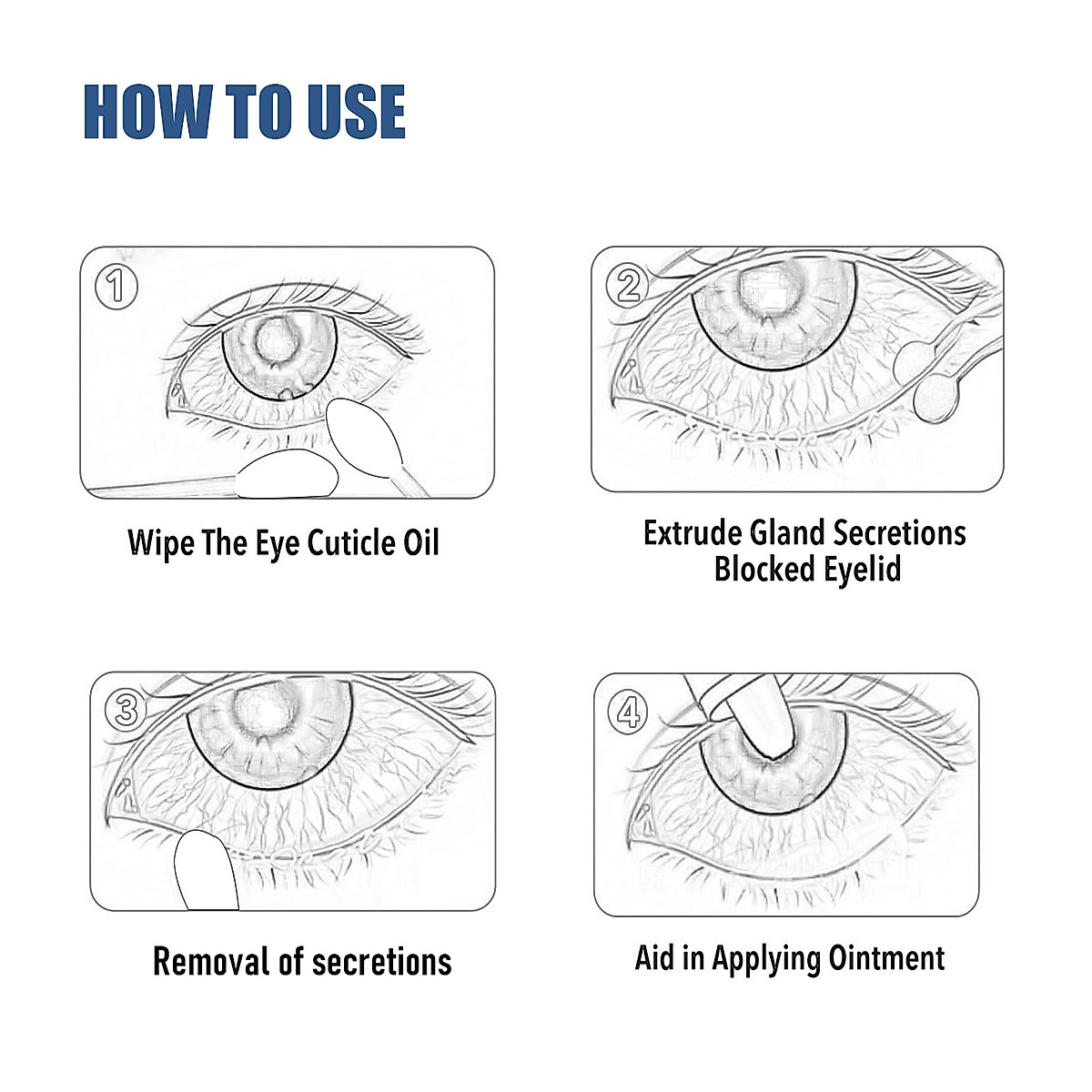 Meibomian Gland Expressor Dry Eye Relief Eyelid Gland Care Clean Tools Kit Eye Stye Treatment Chalazion Remover Meibomian Gland Forceps Titanium Alloy Eyelid Massage Tweezers (Sterile)