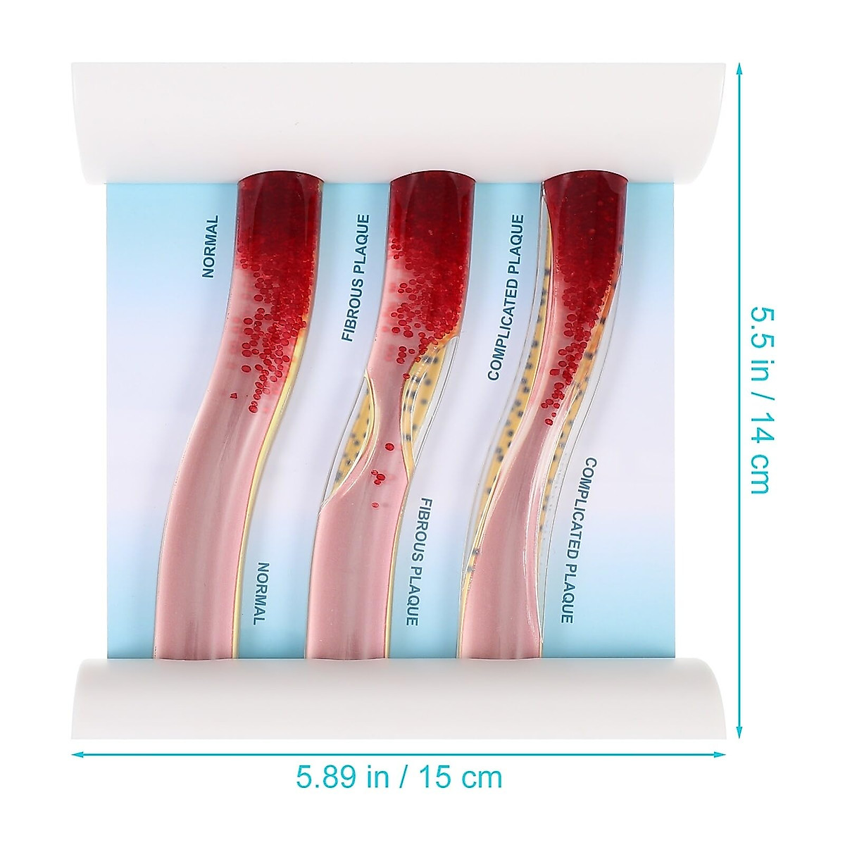 Human Body Skeleton Anatomical Model Low- Density Lipoprotein Blood Vessel Model