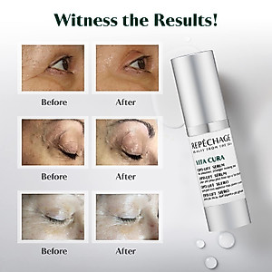 Repechage Vita Cura Opti-Lift Serum - Anti Aging Eye Contour Lifting Effect to Smooth Out Look of Wrinkles and Crow's Feet with Almond Protein, Seaweed Extracts, and Peptides, 15ml /0.5fl oz.