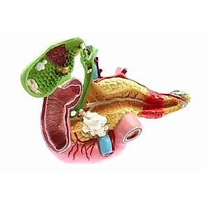 BoNew Human Duodenum Gall Bladder Disease Anatomy Medical Model Life Size