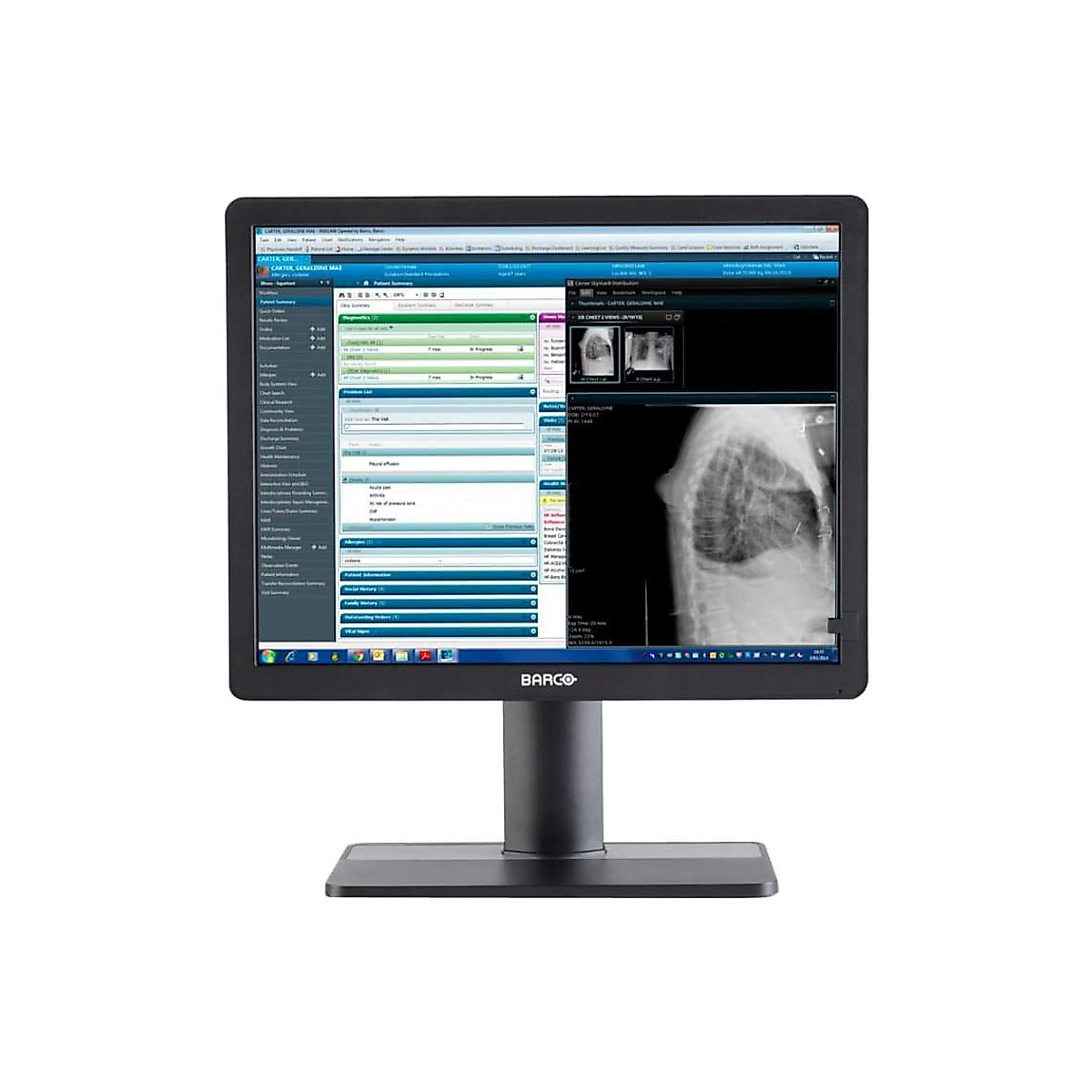 BARCO LED Monitor - 2MP - Color - 21.3" - 1600 x 1200 UXGA - 500 cd/m_ - 1800:1-8 ms - DVI-I, DisplayPort - Black, RAL 9004