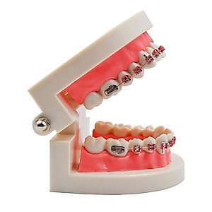 Standard Tooth Teaching Mallocclusion Orthodontic Teeth Model with Brackets Archwire Buccal Tube Tool