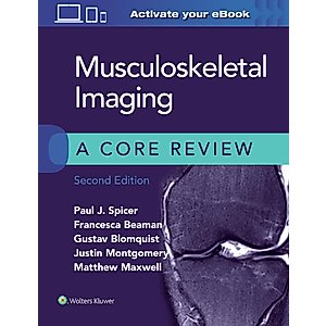 Musculoskeletal Imaging: A Core Review