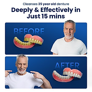 iSonic F3900 Ultrasonic Denture/Aligner/Retainer Cleaner for all dental and sleep apnea appliances, 110V 20W (tank no longer removable) , White , 0.4Pt/0.2L