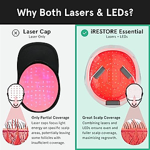 iRestore Essential Laser Hair Growth System + Rechargeable Battery Pack - FDA Cleared Hair Growth for Men & Hair Loss Treatments for Women with Thinning Hair, Hair Regrowth for Women