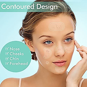 Mandabloom Acne Pimple Patches, 6 Sizes 104 Patches for Large Zit Breakouts, Acne Patches for Face, Chin or Body, Hydrocolloid Bandages Acne Treatment with Tea Tree & Calendula Oil & Salicylic Acid