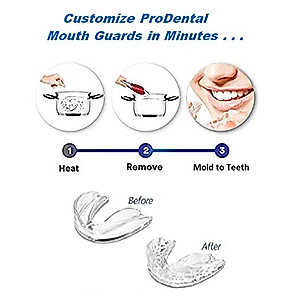 ProDental Thin and Trim Mouth Guard for Grinding Teeth – 3 Pack, Made in USA, Night Guard for Bruxism - Teeth Clenching, Use as Customizable Teeth Whitening Tray