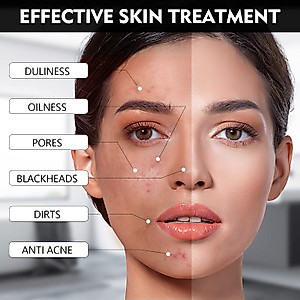 Blackhead Remover Mask Kit 4-in-1 Peel Off Charcoal Face Mask with Vitamin C Serum Blackheads Extractor Tools, and Silicon Brush, Purifying Deep Cleansing Blackheads Acne Mask for Women and Men, 100 g