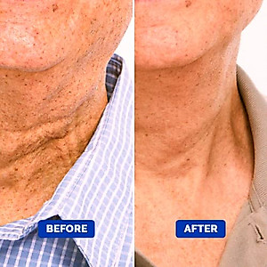 Particle Neck Cream for Men - Neck Firming Cream, Lift and Moisturize The Neck | Use on Saggy Skin or Turkey Neck | Anti Aging Triple Action Neck Cream with Collagen, Hyaluronic Acid, Retinol (50 ml)