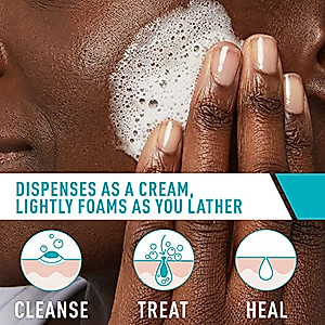 CeraVe Acne Foaming Cream Cleanser | Acne Treatment Face Wash with 4% Benzoyl Peroxide, Hyaluronic Acid, and Niacinamide | Cream to Foam Formula | Fragrance Free & Non Comedogenic | 5 Oz