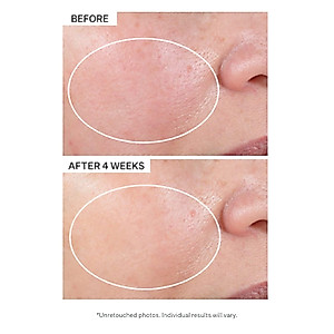 StriVectin Advanced Retinol Intensive Night Moisturizer, Targets Visible Signs of Aging for Healthier Skin, 1.7 Fl Oz