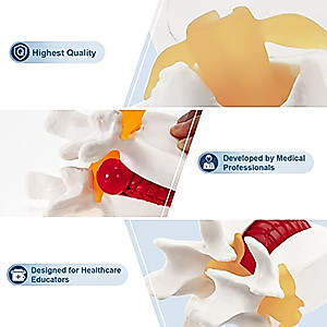 Human Anatomical Lumbar Disc Herniation Model - Lumbar Spine Model for Teaching & Learning - Excellent Way for Demonstrating Disc