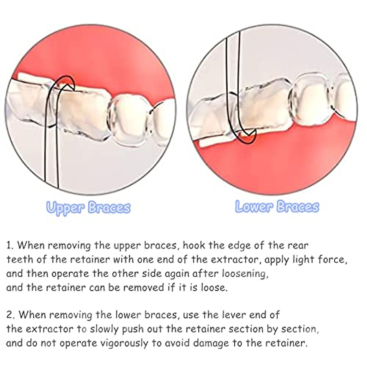 Clear Aligner Removal Tool, 50 Pieces Invisible Removable Braces Extractor Retainer Remover Personal Orthodontic Supplies Braces hook Stealth Hook (Pink, Blue, Purple, Green)