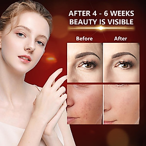 Upgrade Red Light Therapy for Face, 660nm & 850nm Near Infrared Light Therapy, LED Face Light Therapy for Home Skin Care