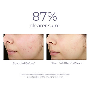 DERMA E Acne Oil Control Face Moisturizer, 2 Oz, Matte Moisturizer with Salicylic Acid, Tea Tree Oil & Aloe Vera, Face Cream Rebalances Sebum Production & Prevents Blemishes, Redness & Breakouts 2 Oz