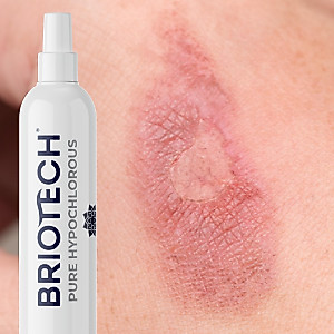 BRIOTECH Pure Hypochlorous Acid Spray and Cleanser, Original Premium HOCl Topical Solution, Multi-Purpose Cleaner, Family Approved & Pet Friendly, 1 gal refill ea, 2 ct