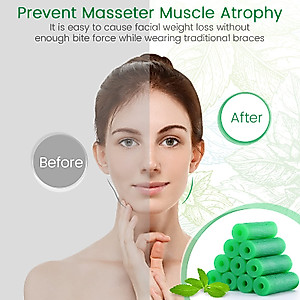 Aligner Chewies for Invisalign Aligners - Mint Scented (20Pcs Chewies) and 2 Aligner Removal Tools