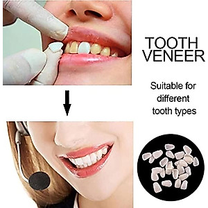 Tempoary Tooth Repair Kits DIY Dental Care Kit Glue for Filling Missing Broken Teeth Crowns and Bridges Moldable Fake Teeth to Regain Your Beautiful Smile in Minutes-White Color