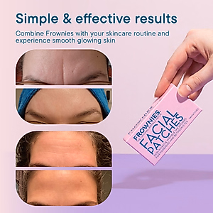 FROWNIES Forehead and Between the Eyes Facial Patches - Hypoallergenic Patches to Smooth & Soften Forehead Horizontal & Eleven Lines - For Overnight Use, 144 count