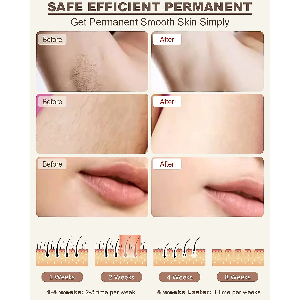 GERCY Laser Hair Removal for Women Permanent, Painless at-Home IPL Hair Removal Device Upgraded to 999,999 Flashes, 5 Level Energy Adjustable & 6 Flash Modes for Beautify Skin, Face, Body, Bikini