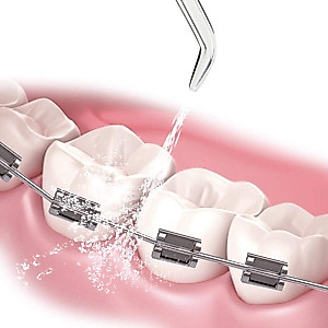 Flosser Replacement Tips for Waterpik Water Flosser, High-Pressure Jet Tips, Flosser Refill Replacement Heads, Compatible with Waterpik Oral Irrigator and Dental Flossers, Orthodontic Tips 4 Packs