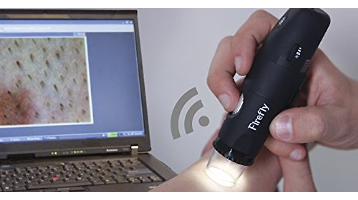 Firefly DE350 Wireless Dermatoscope - Capture in High Detail