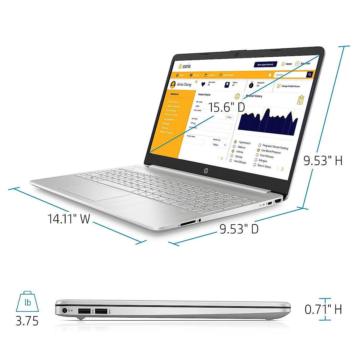 HP 2022 Newest Notebook Laptop, 15.6" Full HD 1080P Touchscreen, 11th Gen Intel Core i3-1115G4 Processor, 8GB RAM, 256GB SSD, HDMI, Webcam, Wireless-AC Wi-Fi 5, Bluetooth 4.2, Windows 11 Home, Silver