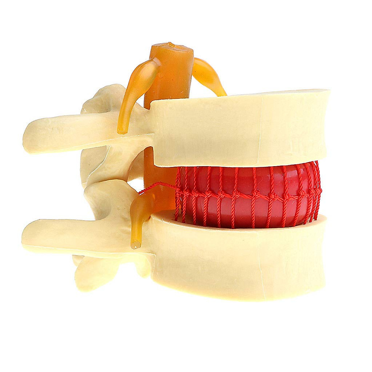 BONEW 4PCS Magnify 2X Human Spine Lumbar Vertebrae Degenerative Disc Medical Model