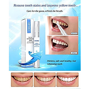 EFERO Teeth Whitening Essence Removes Plaque Stains Tooth Bleaching Cleaning Serum White Teeth Oral Hygiene Tooth Whitening Pen (Essence and Pen)