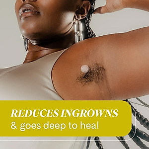 Fur Ingrown Concentrate and Microdart Patches Bundle: Smoothe, Soothe, and Treat Ingrown Hairs and Effectively Clear Up Ingrown Hair Bumps