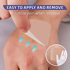 Conkote Hydrocolloid Wound Dressing 4”x 4”, Sterile Adhesive Patches, Box of 10 Dressings