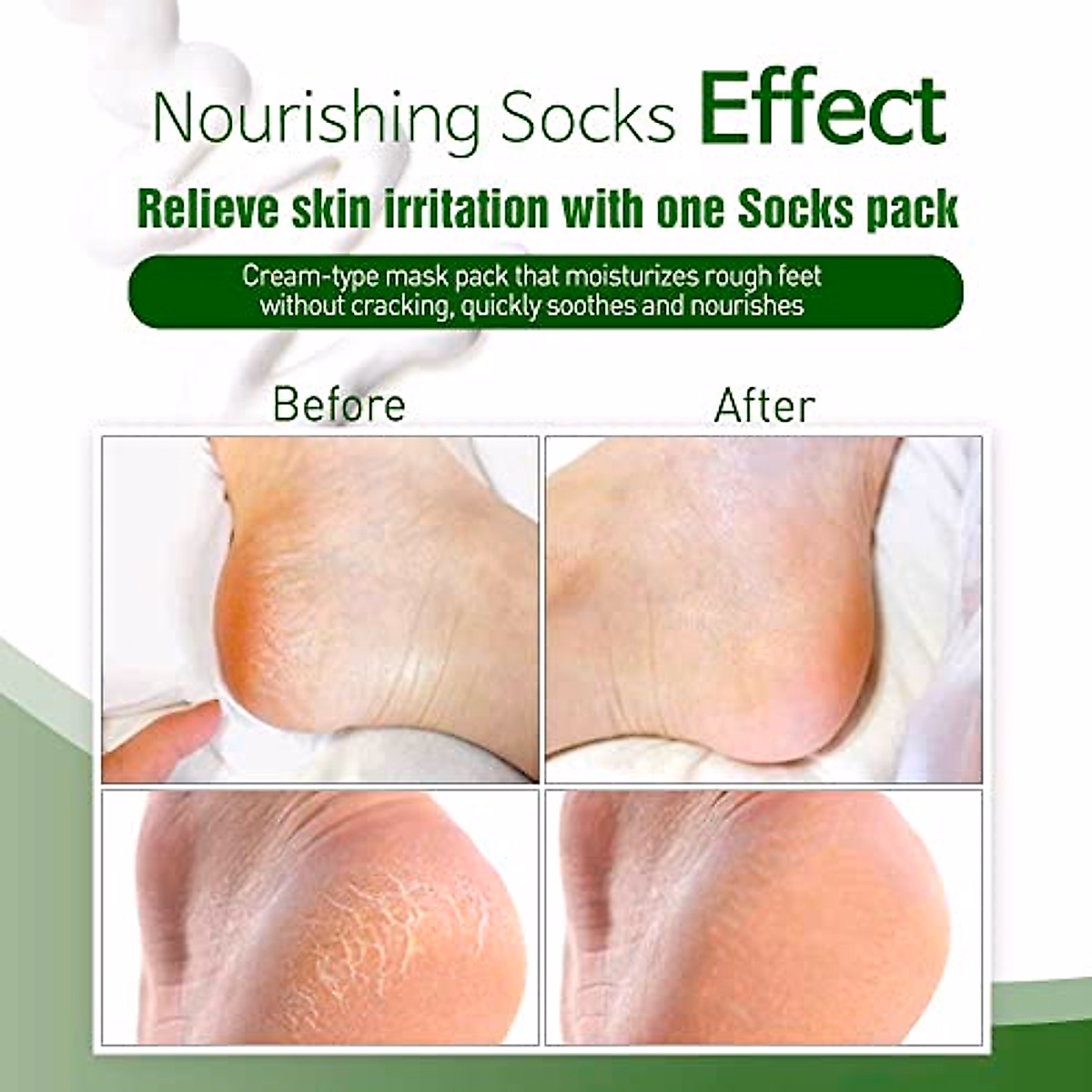 Epielle Nourishing Foot Masks - Hemp + Rosemary Extract for Deep Moisturizing 100% Vegan & Cruelty-Free (Socks 6pk), Beauty Gifts | Skincare Gifts | Skincare Party Favors. Stocking Stuffers!!