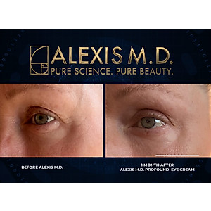 ALEXIS M.D. Profound Eye Cream | 30ml | 1oz