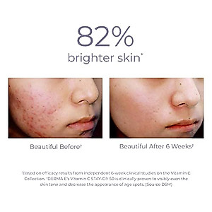 DERMA-E Vitamin C Cleanser - Daily Brightening Cleanser – Hydrating Face Wash to Even Out Skin Tone – Moisturizing Face Cleanser for a Radiant Glow, 6 fl oz