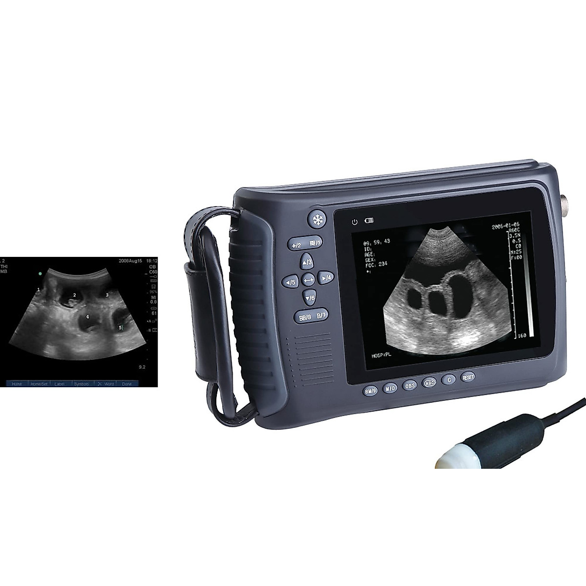 Ultrasound Machine for Pregnancy Portable ecografo portatil Scanner Handheld Doppler for Small Baby Dog sonogram ultrasounds veterinario Veterinary Portable Ultrasound for Bladder Dogs