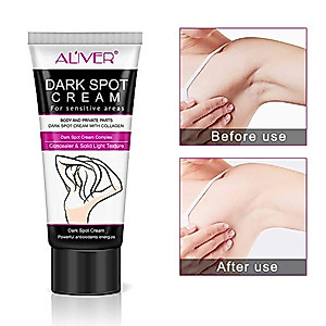 Dark Spot Cream, Natural Underarm Cream, Dark Spot Cream Corrector for Neck and Dark Spots, Sun Spots, Age Spots, Hyperpigmentation, Even Sensitive Skin-Instant Result