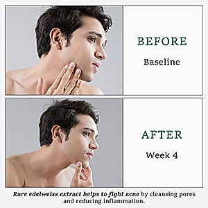IGAME Mantisfy Clear Skin Made Easy | Men's Facial Cleanser with Rare Glacier Edelweiss Essence | Acne-Fighting & Oil-Control | Hydrating & Moisturizing | 5.27 Fl Oz