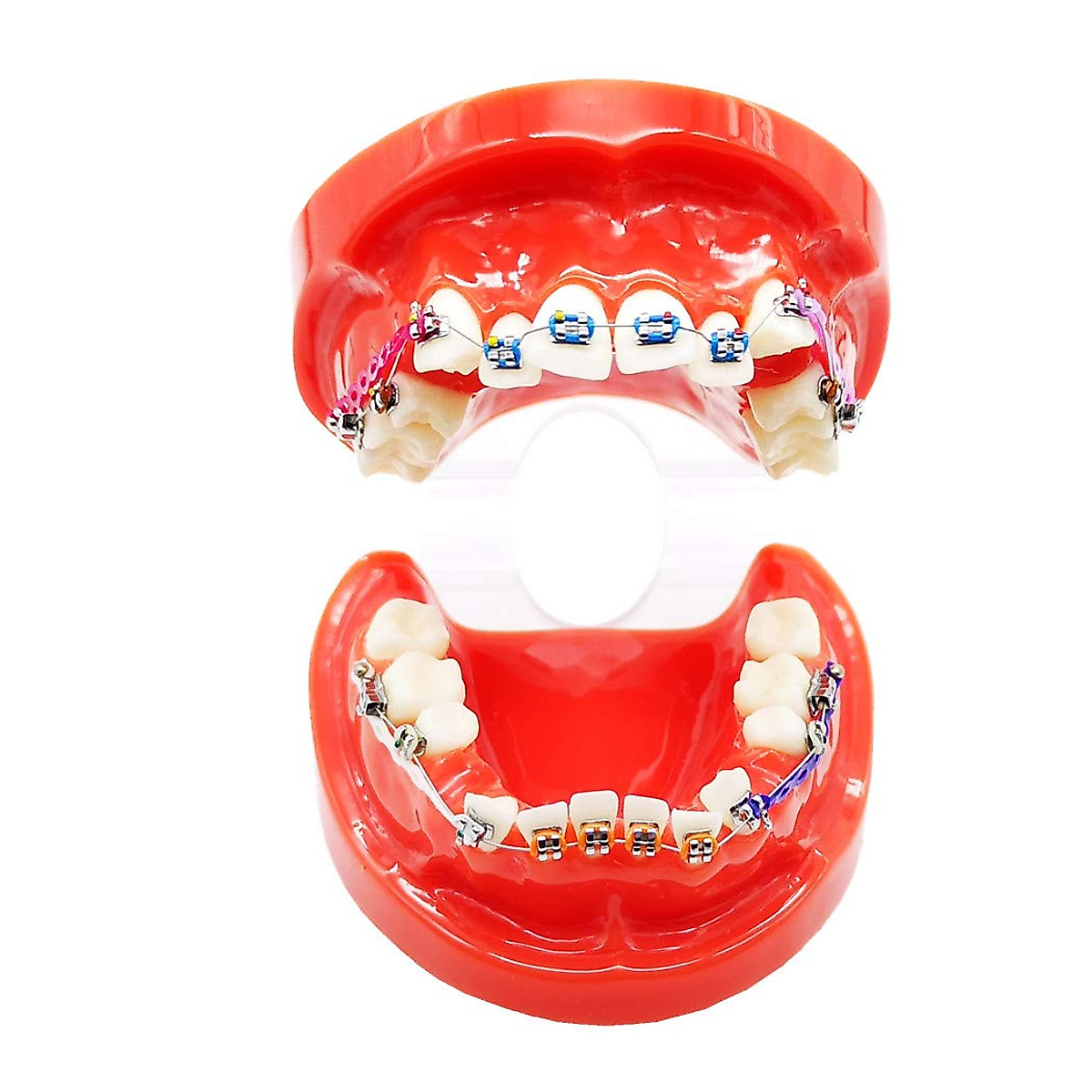 Dental Typodont With Metal Brackets Orthodontic Teeth Model With Ligature Ties Red