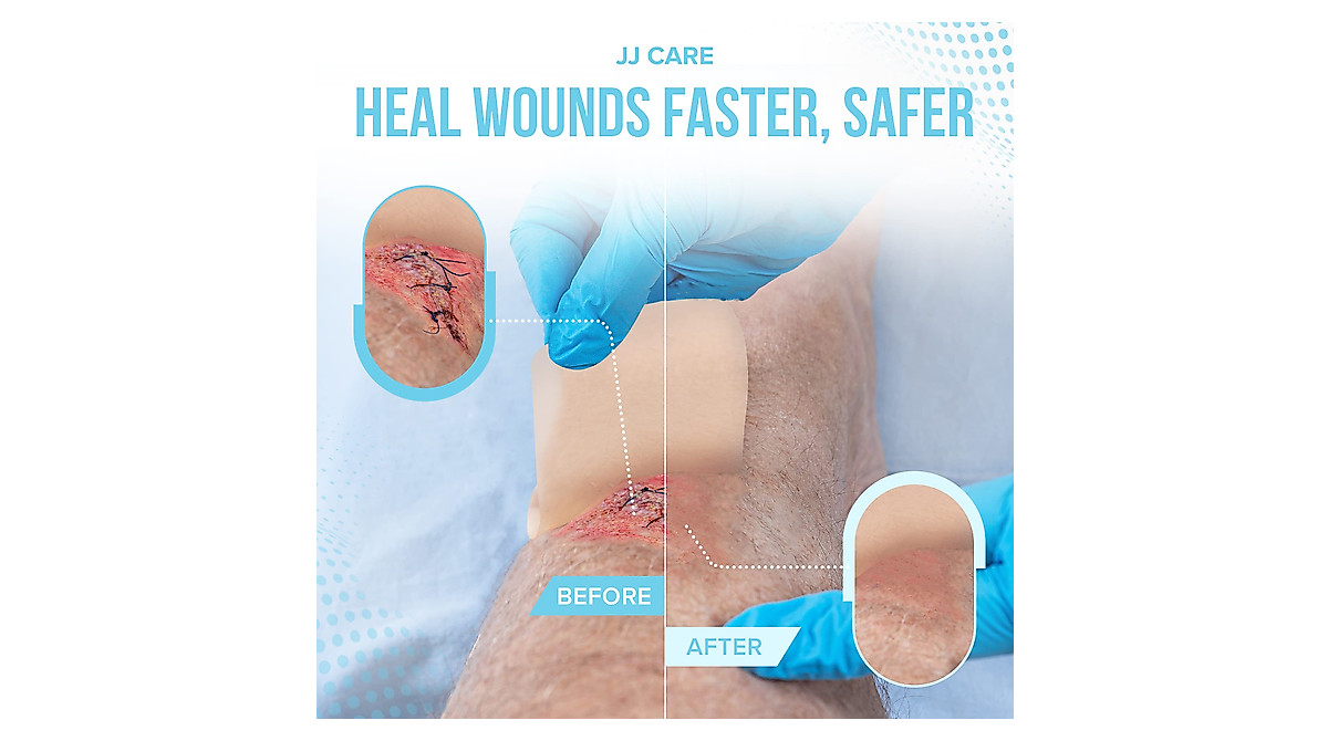 JJ CARE Hydrocolloid Dressings for Faster Wound Healing