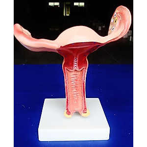 Model Anatomy Professional Medical Uterus Magnified New IT-086 ANGELUS