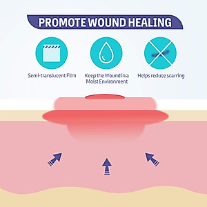 Conkote Hydrocolloid Wound Dressing 4”x 4”, Sterile Adhesive Patches, Box of 10 Dressings