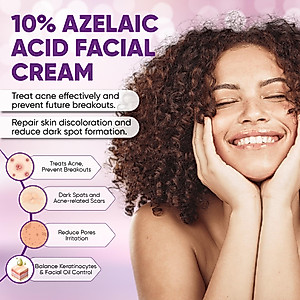 AOBBIY Azelaic Acid 10% Acne Treatment Cream, Redness Relief for Face, Redness Reducing Skin Care, Prevent Acne Breakouts, Balance Excess Sebum, Ease Pimple Clarify Skin Soothe Irritation,1 oz