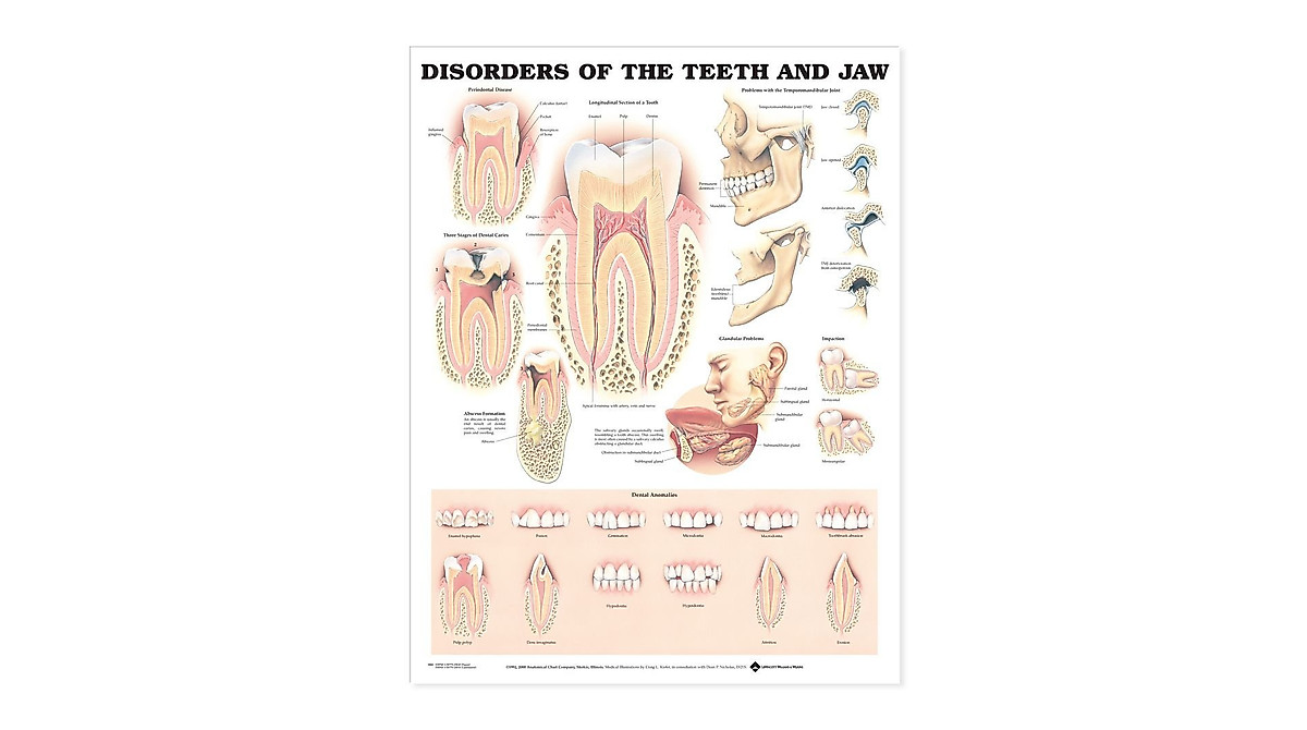 Disorders of the Teeth and Jaw Anatomical Chart - Dental Reference Guide