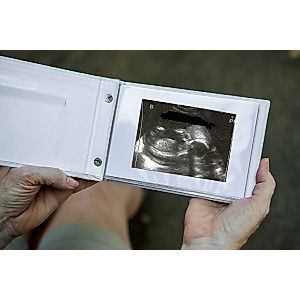 Pregnancy/Maternity Ultrasound And Photo Album/Keepsake