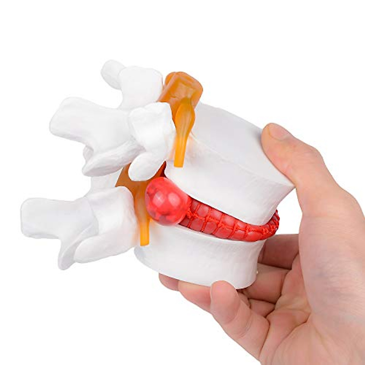 Anatomical Herniated Lumbar Vertebrae Disc Prolapse Model Human Medical Anatomy