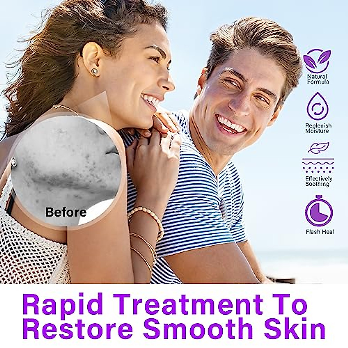 Azelaic Acid 12% Facial Serum,Skin Brightening Hyaluronic Acid and Niacinamide, Redness Relief, Fade and Repair Dark Spots