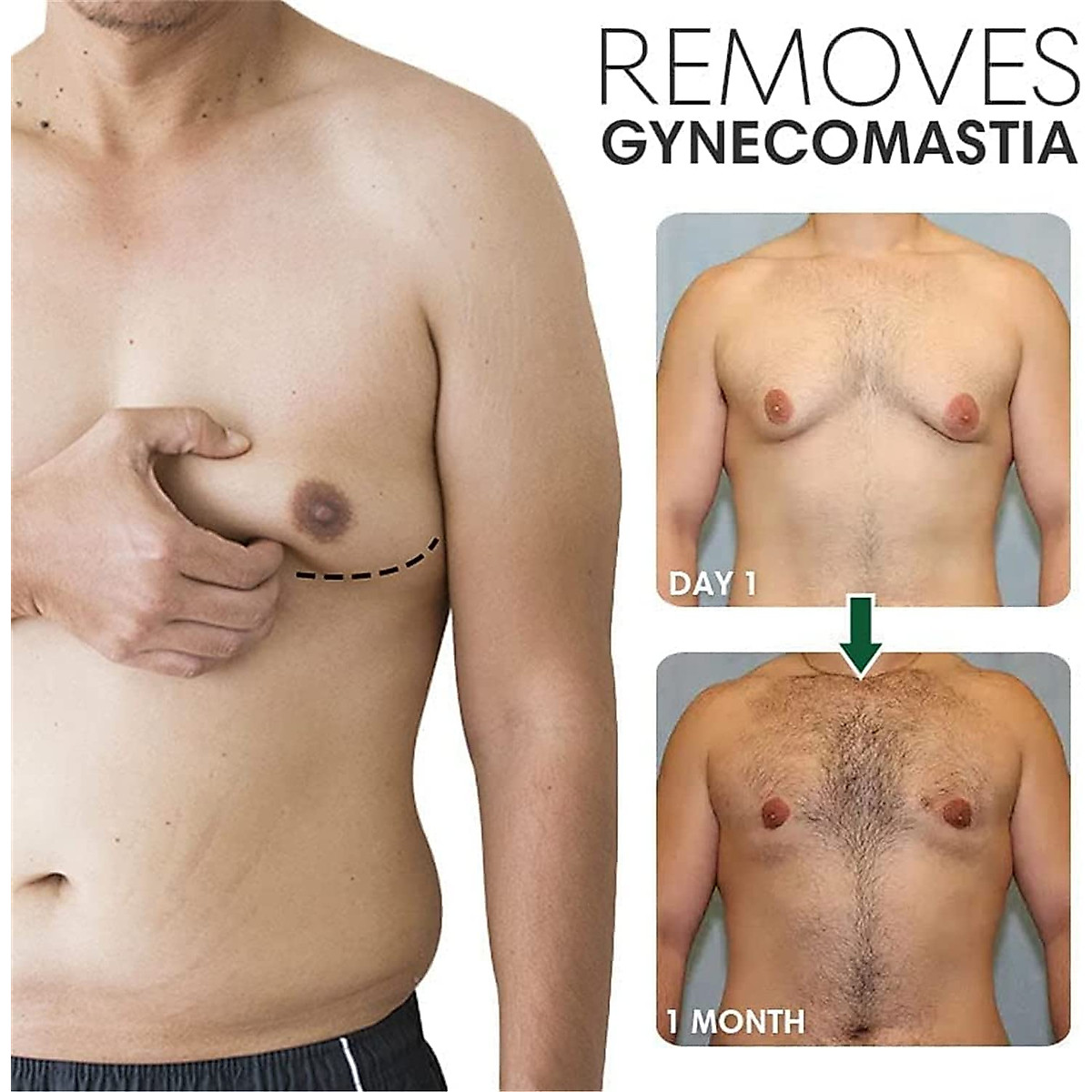 Aolodoo SoliPac Gynecomastia Tightening Ginger Cream,Gynecomastia Tightening Ginger Cream,Fat Burning Anti-Cellulite Slimming Cream,Effective Remove Excess Fat (3pcs)