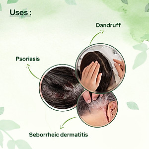 Cosalic Coal Tar and Salicylic Acid Solution Dandruff Free Shampoo with Salicylic Acid for Dry Scalp, Itch Relief, Psoriasis & Seborrheic Dermatitis - 6.8 Fl Oz(Pack of 2)